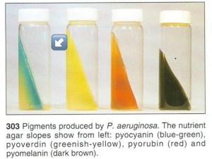 What is Chloronychia, or nail greenies?