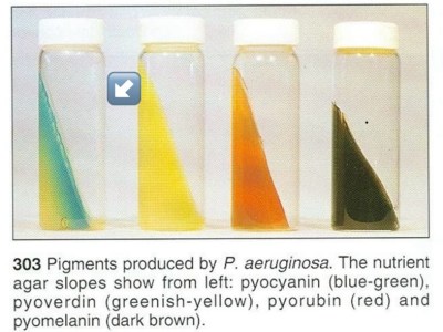 What is Chloronychia, or nail greenies?