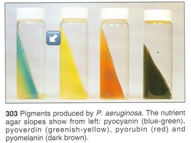 What is Chloronychia, or nail greenies?